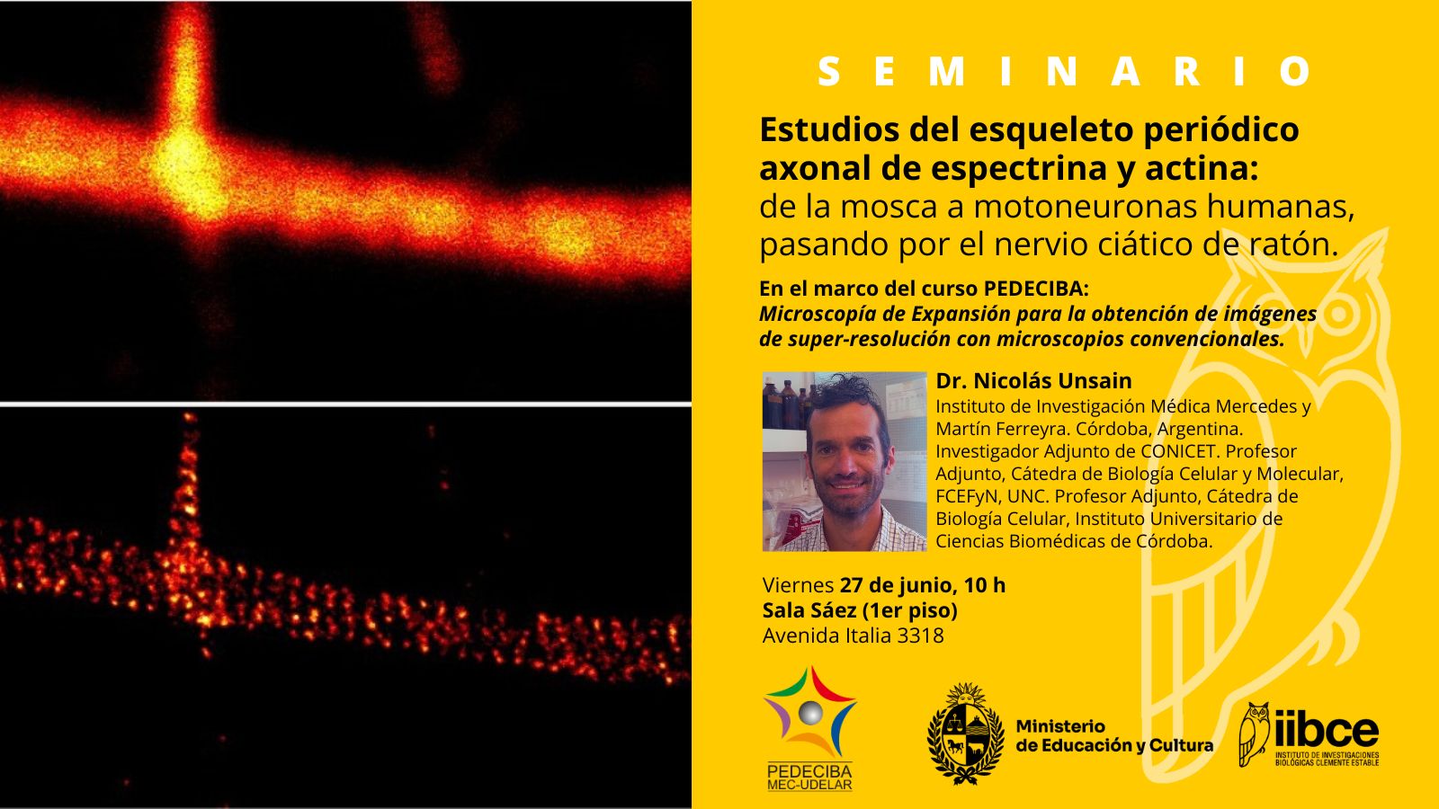 Seminario - Estudios del esqueleto periódico axonal de espectrina y ...